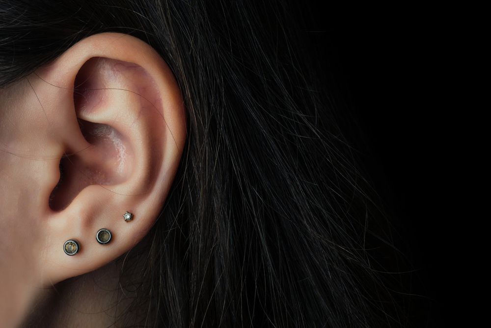 Cicatriz Queloide En Tu Piercing Qu Se Debe Hacer Multiestetica mx Cicatriz Queloide En Tu Piercing Qu Se Debe Hacer Multiestetica mx