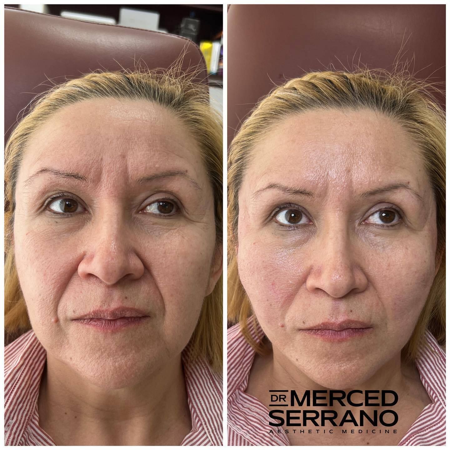 Dr. Merced Serrano - Multiestetica.mx