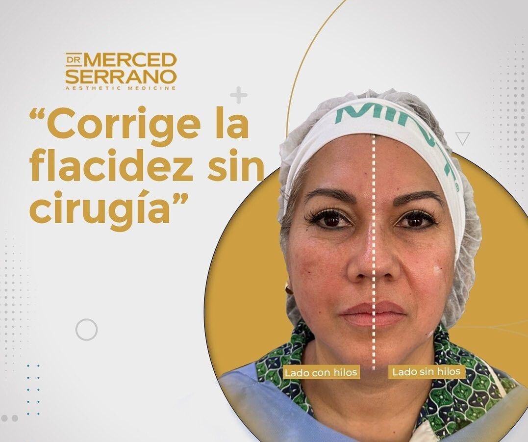 Dr. Merced Serrano - Multiestetica.mx