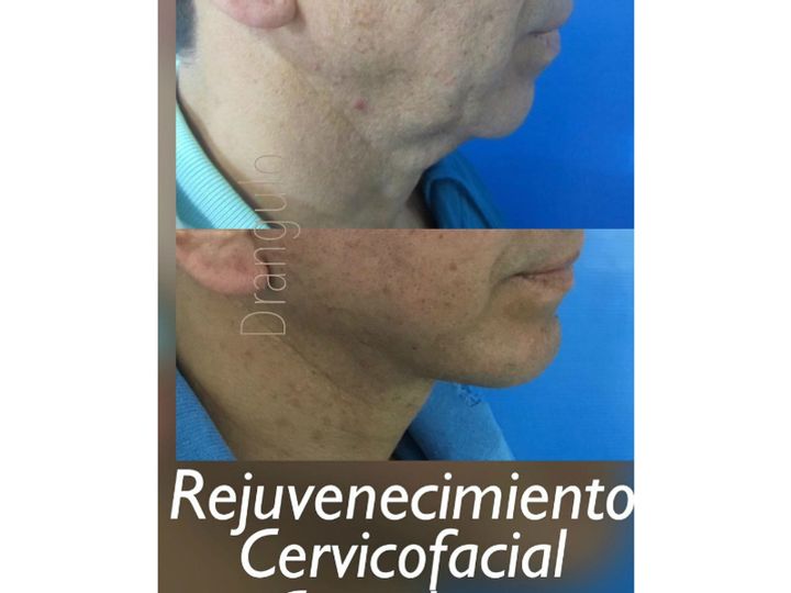 Dr. Héctor Angulo Romero - Multiestetica.mx