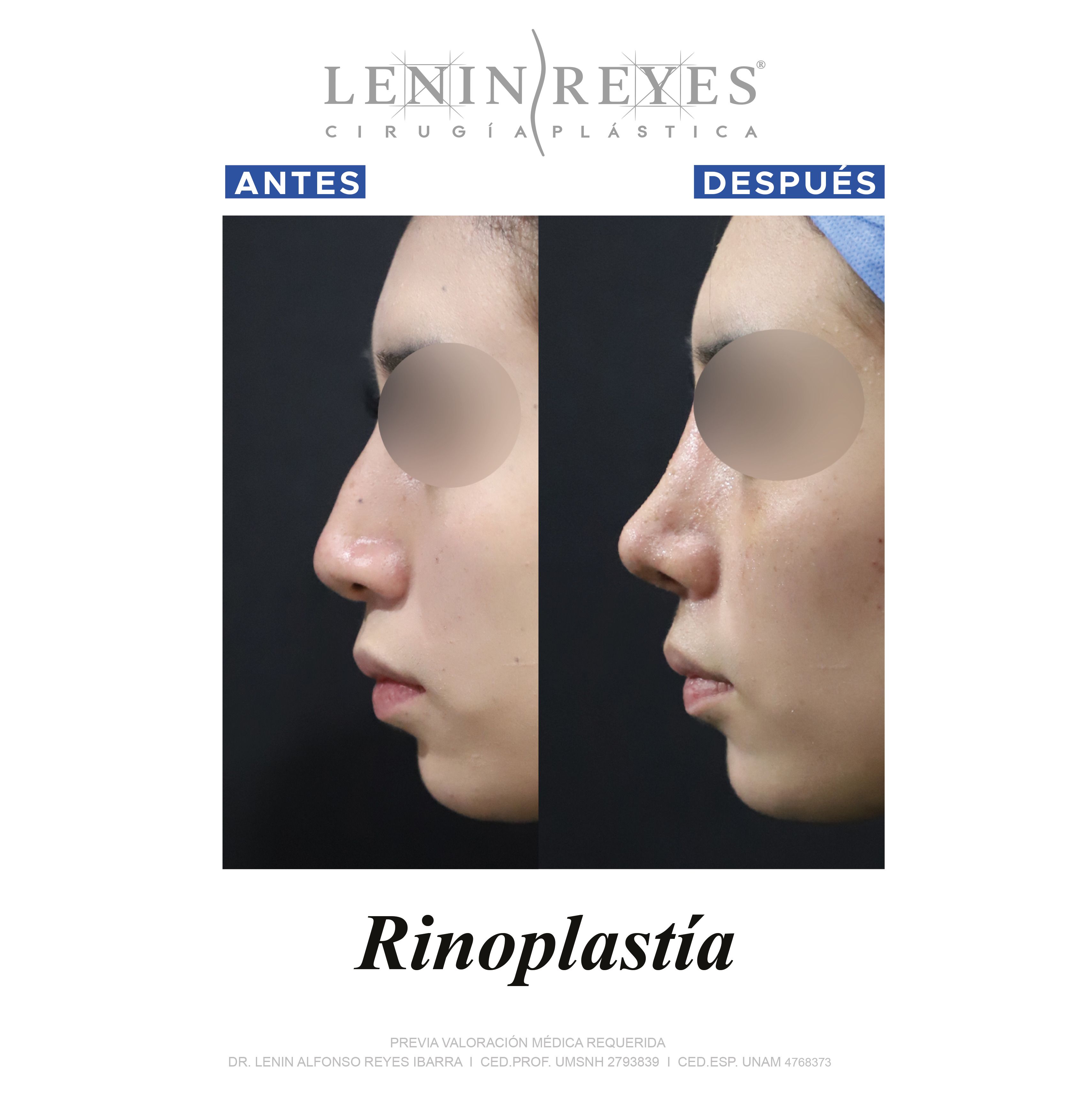 Dr. Lenin Alfonso Reyes Ibarra - Multiestetica.mx