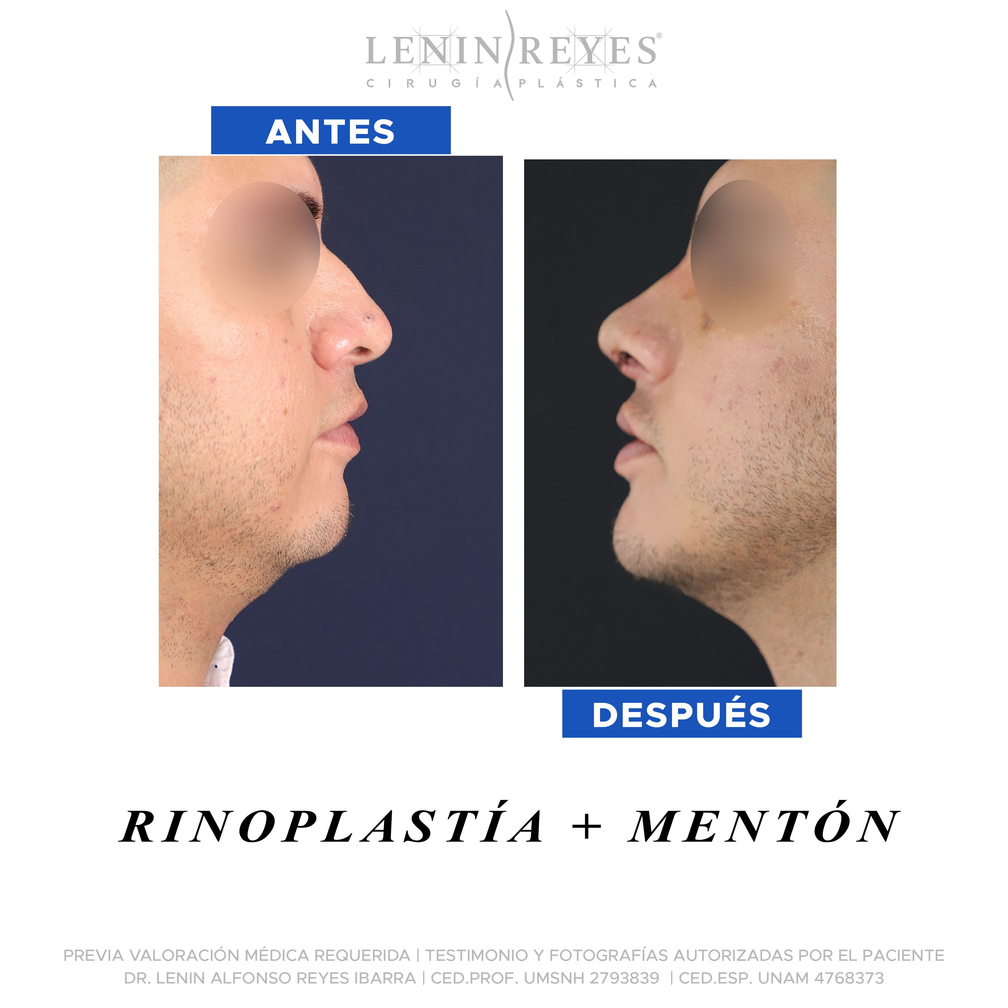 Dr. Lenin Alfonso Reyes Ibarra - Multiestetica.mx