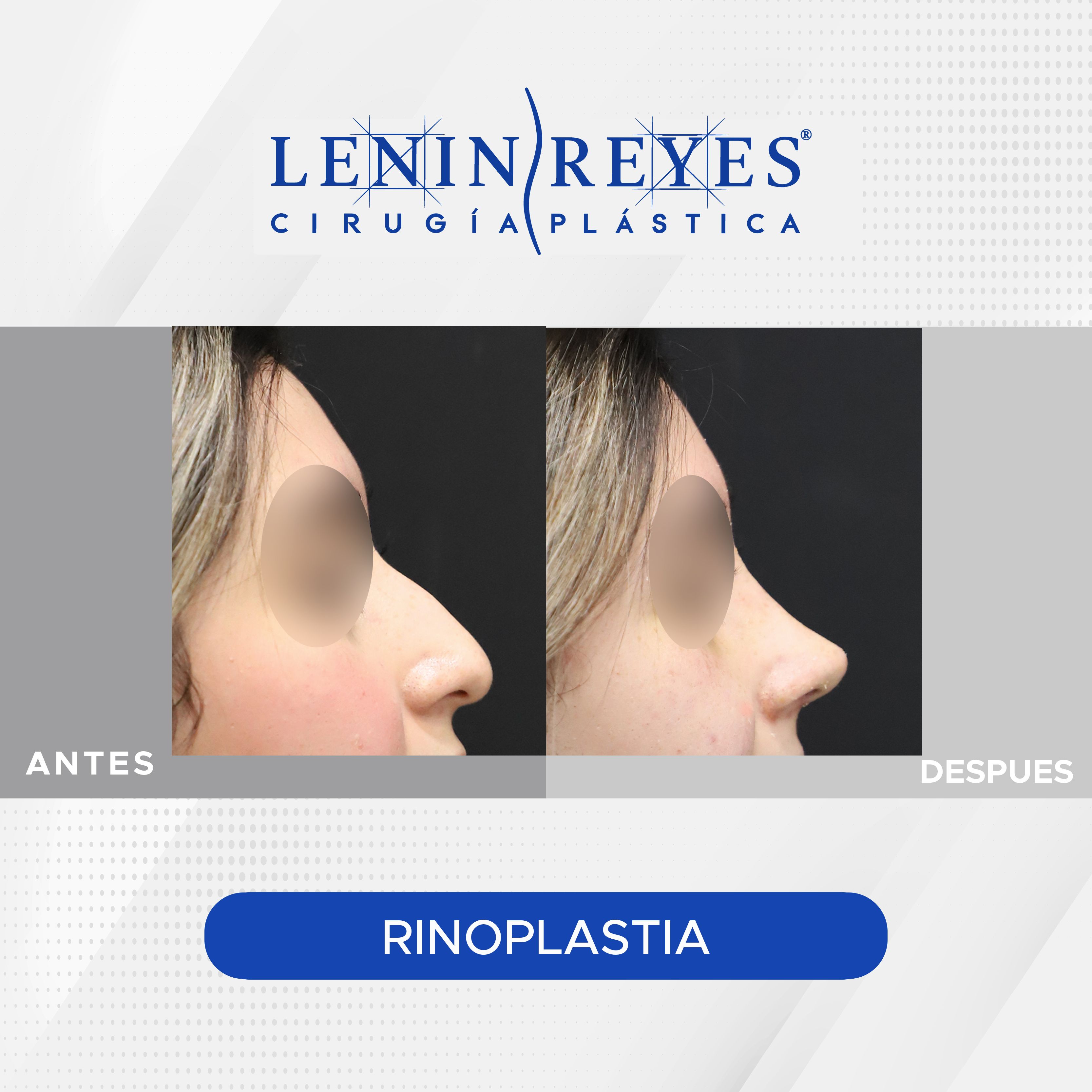 Dr. Lenin Alfonso Reyes Ibarra - Multiestetica.mx