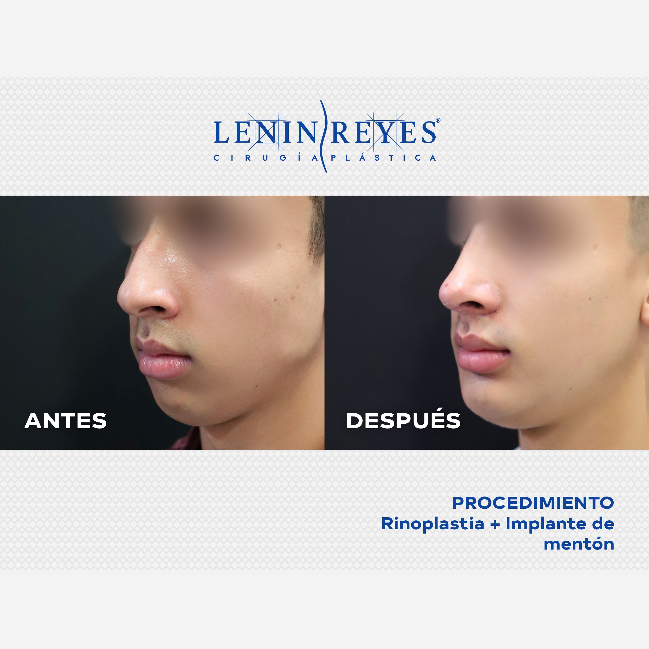 Dr. Lenin Alfonso Reyes Ibarra - Multiestetica.mx