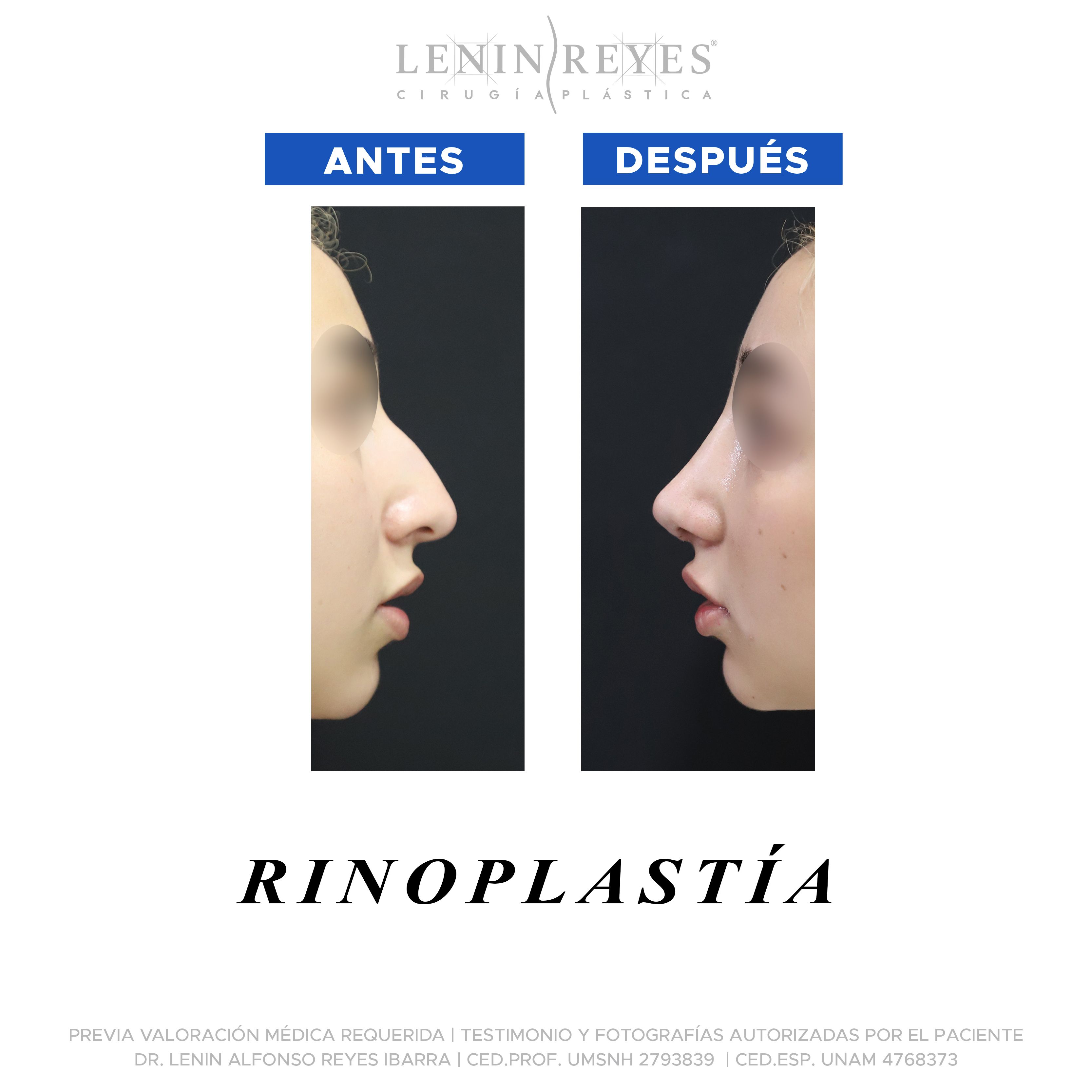 Dr. Lenin Alfonso Reyes Ibarra - Multiestetica.mx