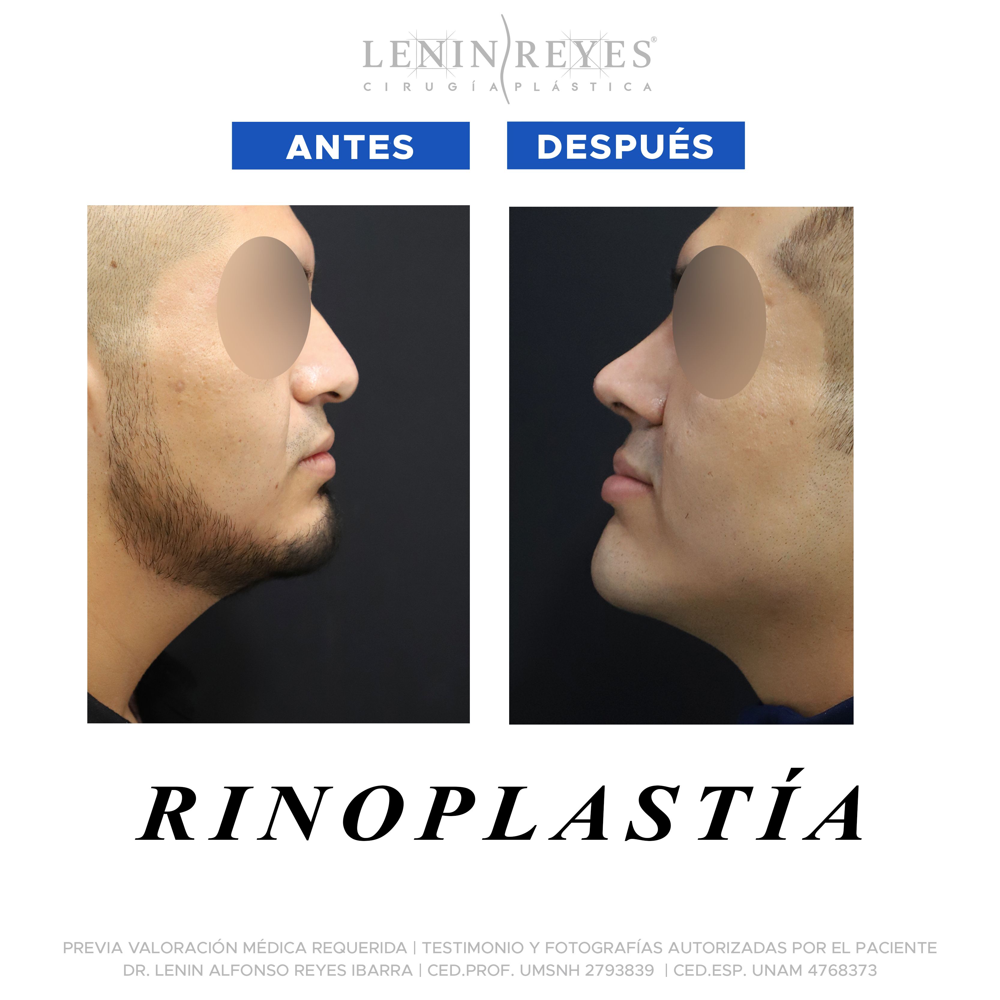 Dr. Lenin Alfonso Reyes Ibarra - Multiestetica.mx