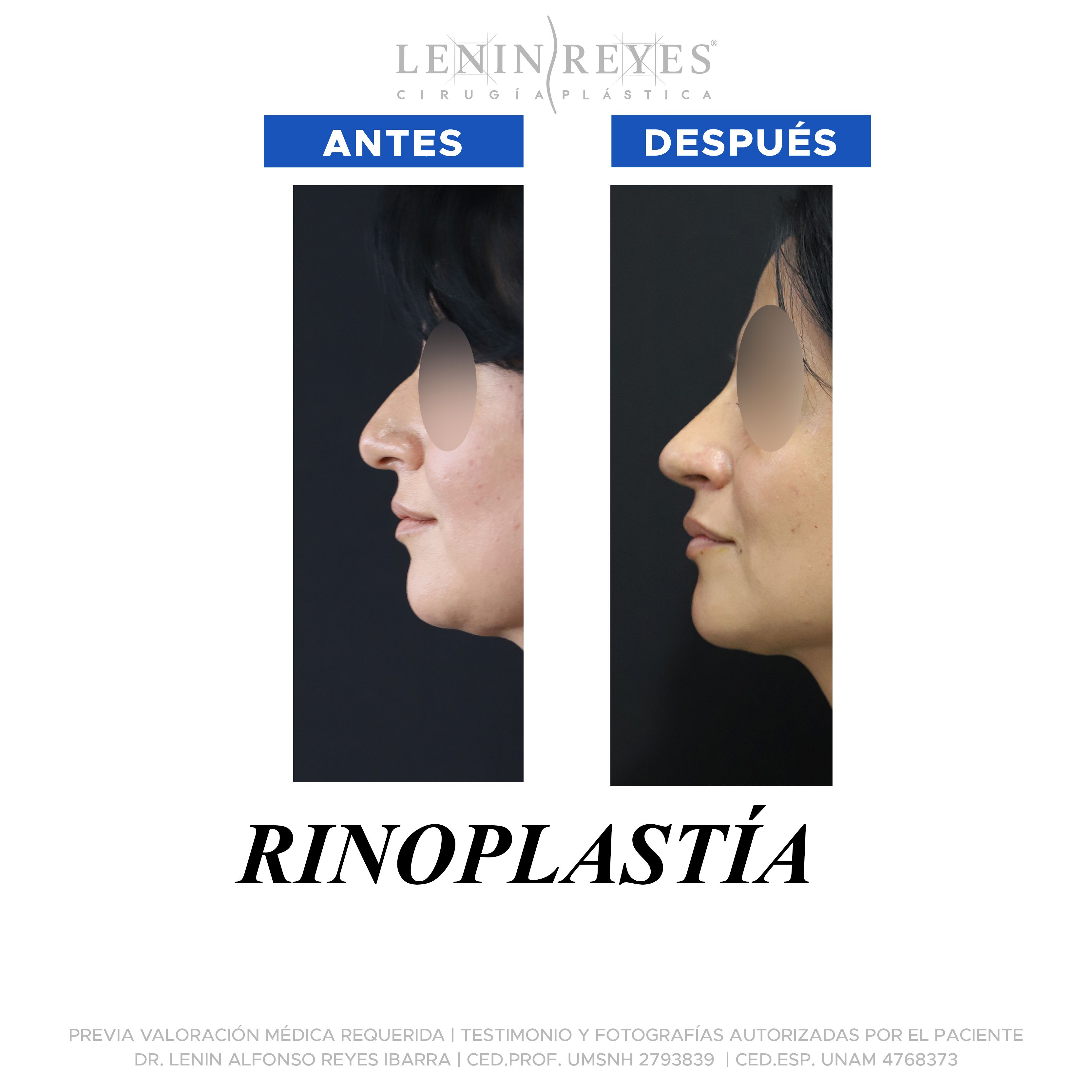 Dr. Lenin Alfonso Reyes Ibarra - Multiestetica.mx