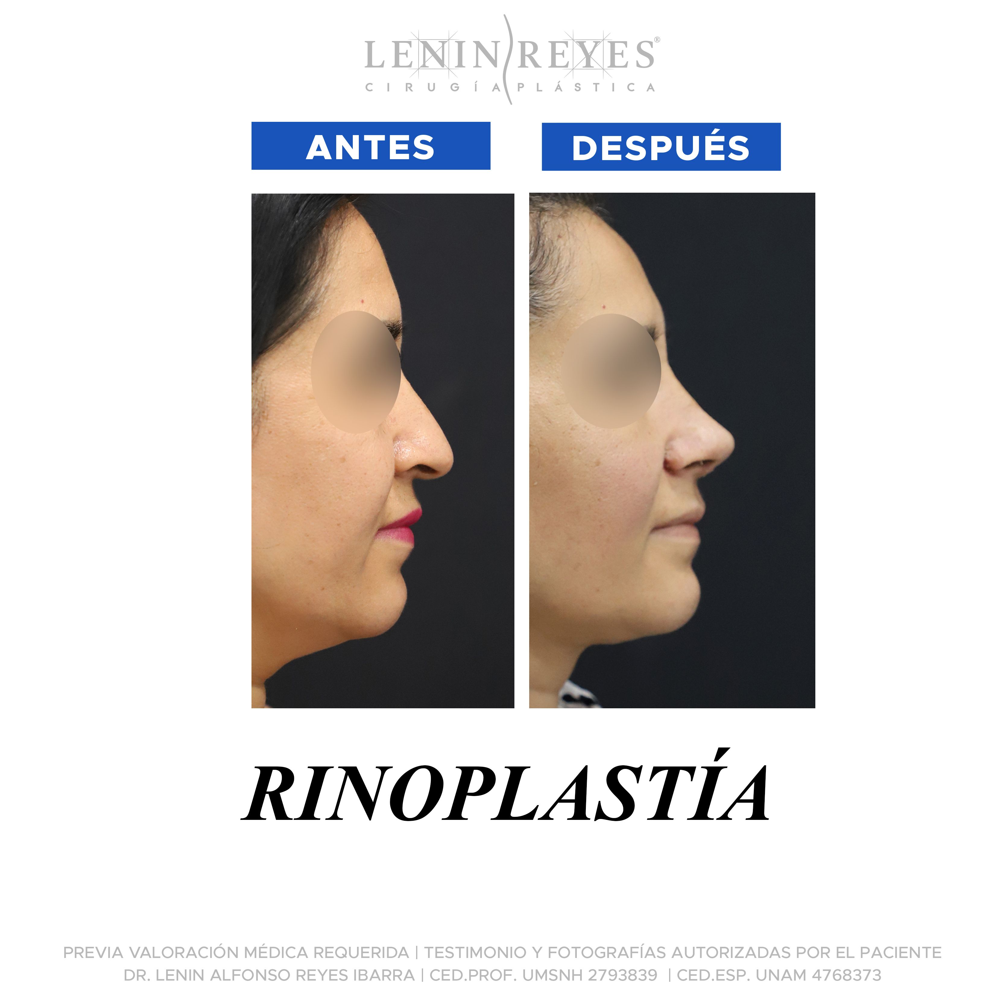 Dr. Lenin Alfonso Reyes Ibarra - Multiestetica.mx