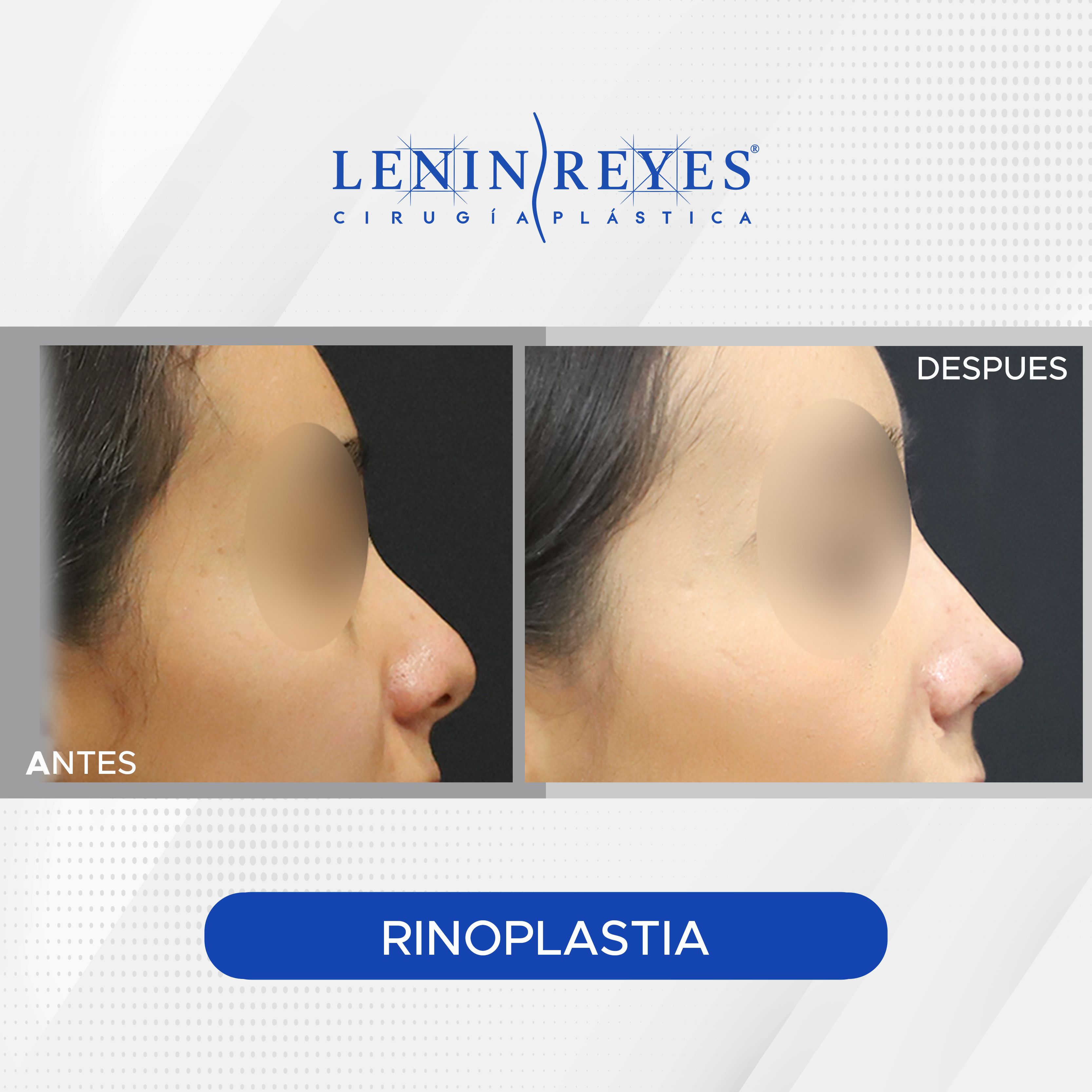 Dr. Lenin Alfonso Reyes Ibarra - Multiestetica.mx