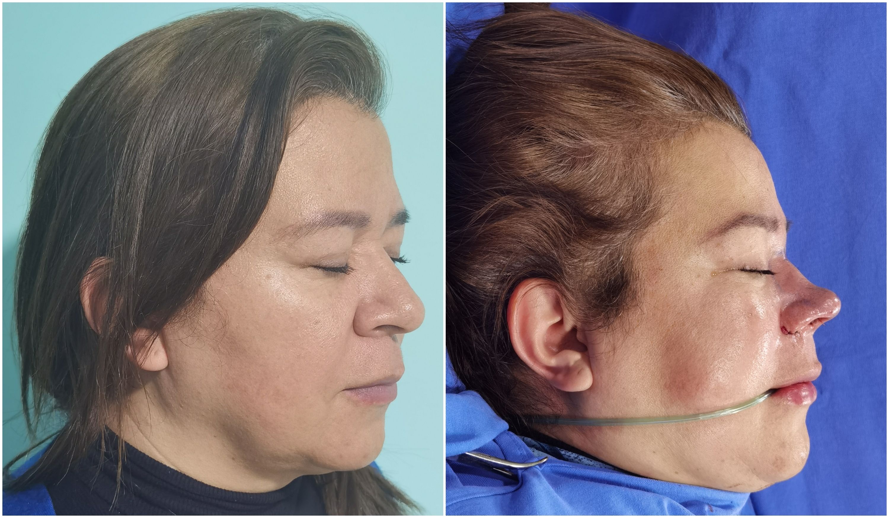 Dr. Gerardo Rascon - Multiestetica.mx