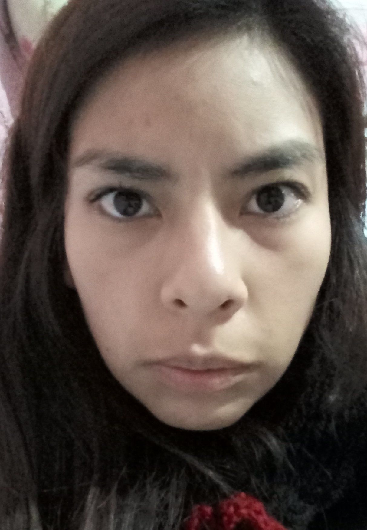 Quijada y cara chueca - Cirugía maxilofacial - Multiestetica.mx