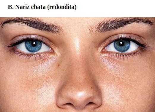 Nariz: ¿Respingada o chata?, Karen_Multiestetica, oct 2018